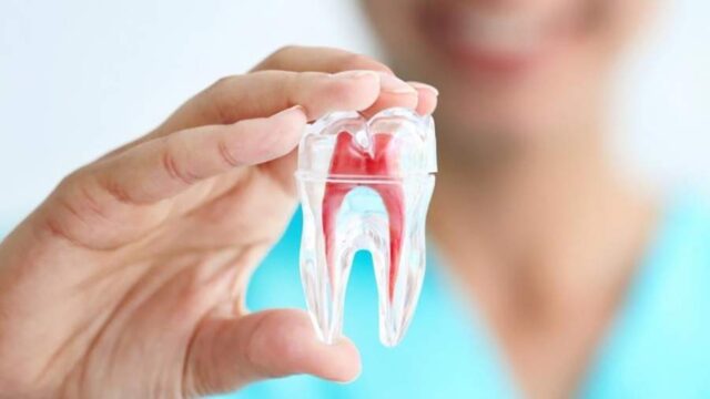 Root Canal Treatment (RCT) - The Walk-in Dental Centre